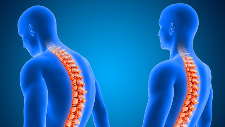 Spinal Injections for Pain Management - Synergex Med Blog
