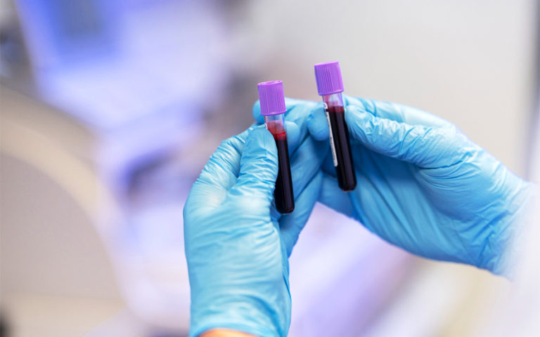 Platelet-Rich Plasma Injections – Synergex Med Blog